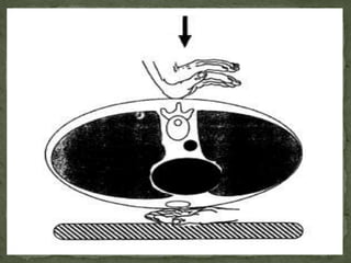 Prone cpcr | PPTX | First Aid | Injuries
