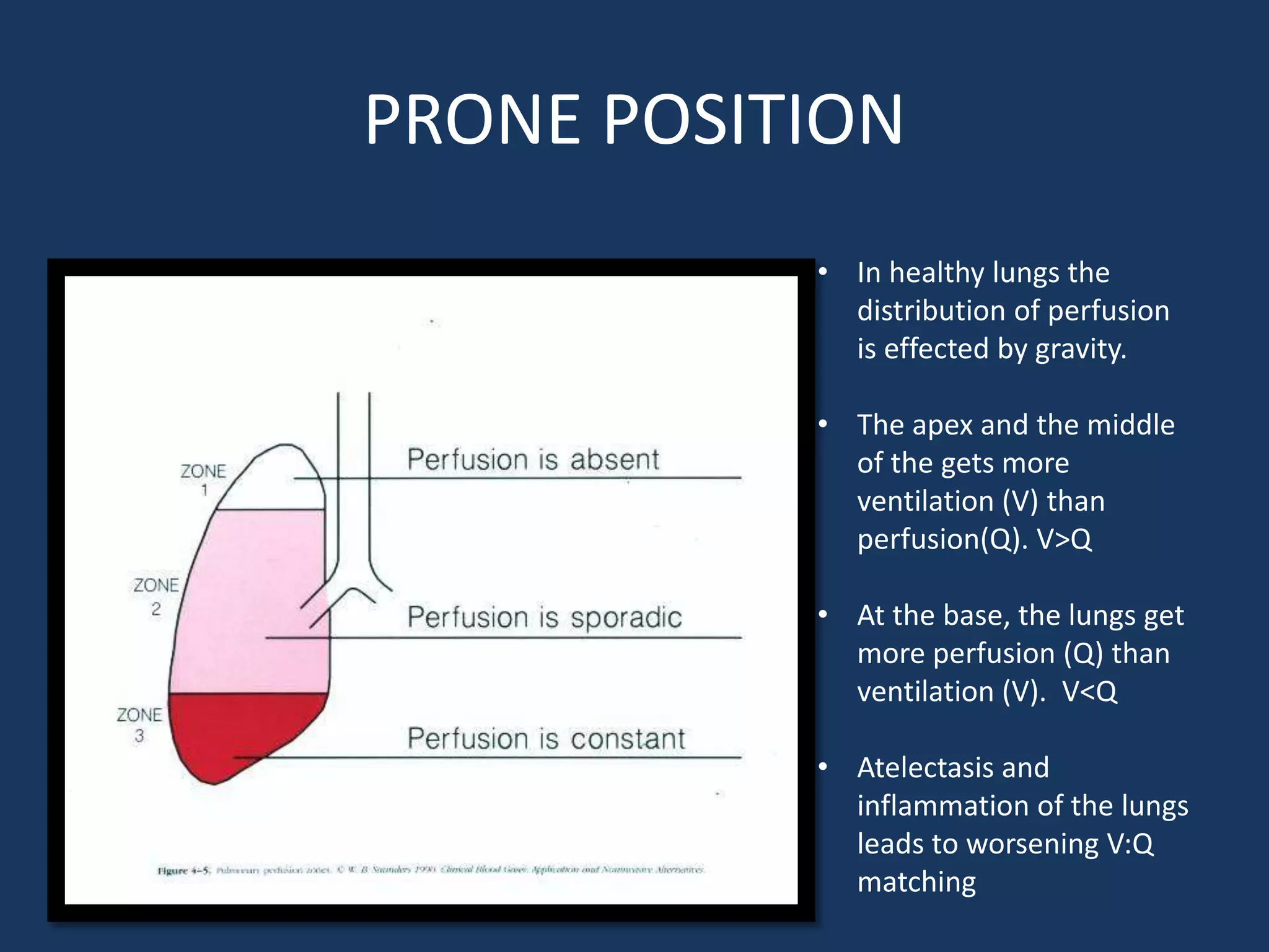 Prone Position | PPTX