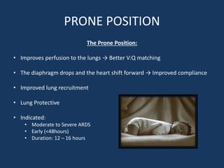 Prone Position Ards