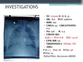 Prone ventilation | PPTX