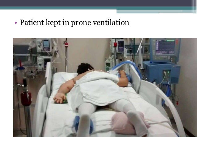 Prone ventilation