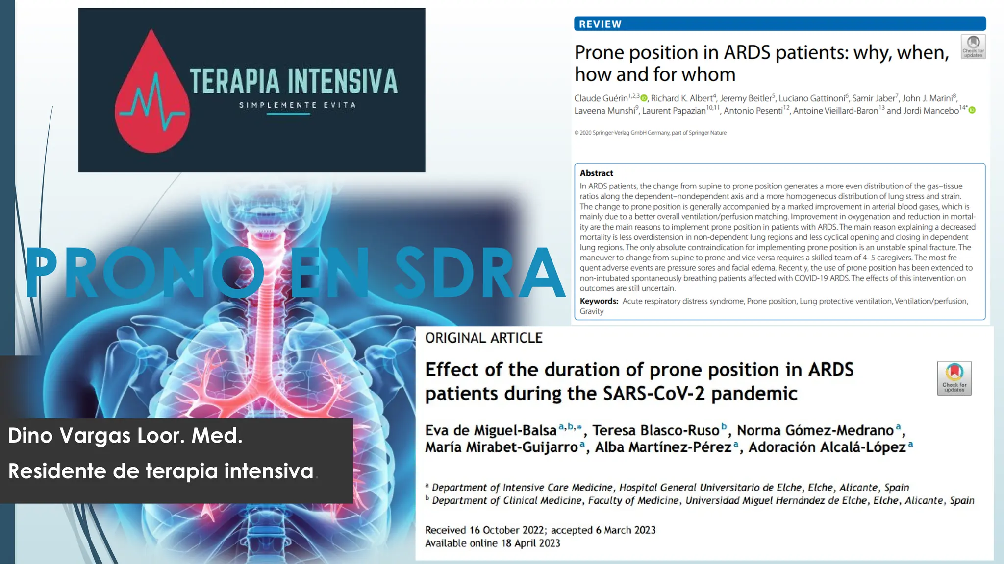 DECUBITO PRONO EN SINDROME DE DISTRES RESPIRATORIO AGUDO | PPTX