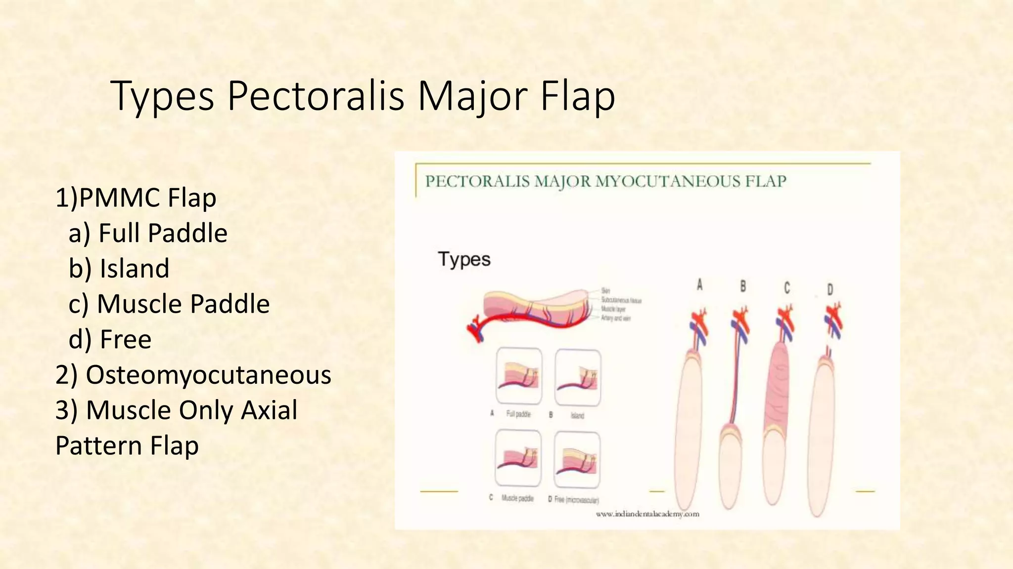 Case Presentation On Reconstruction With Pectoralis Major Myocutanious ...