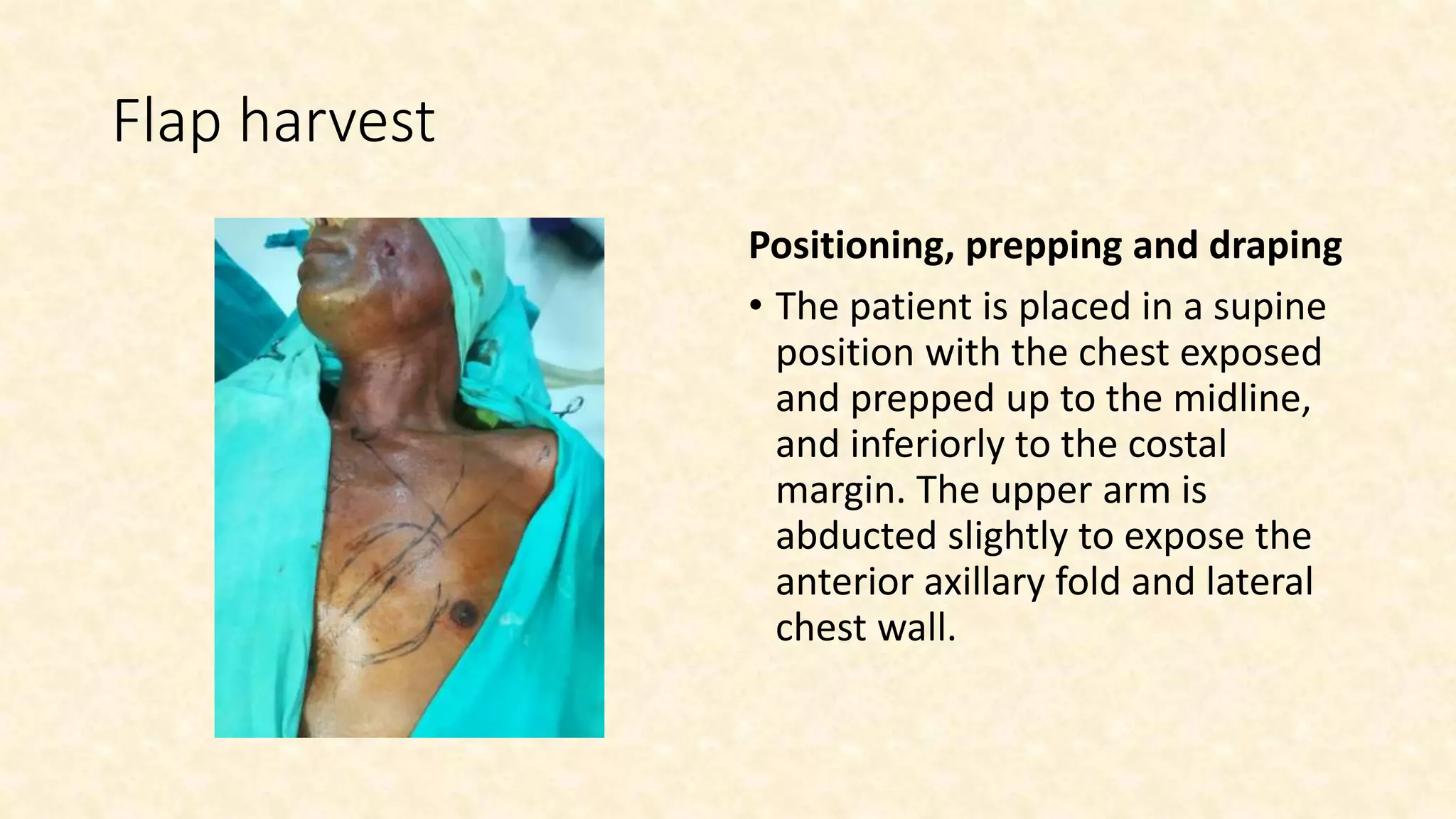 Case Presentation On Reconstruction With Pectoralis Major Myocutanious ...