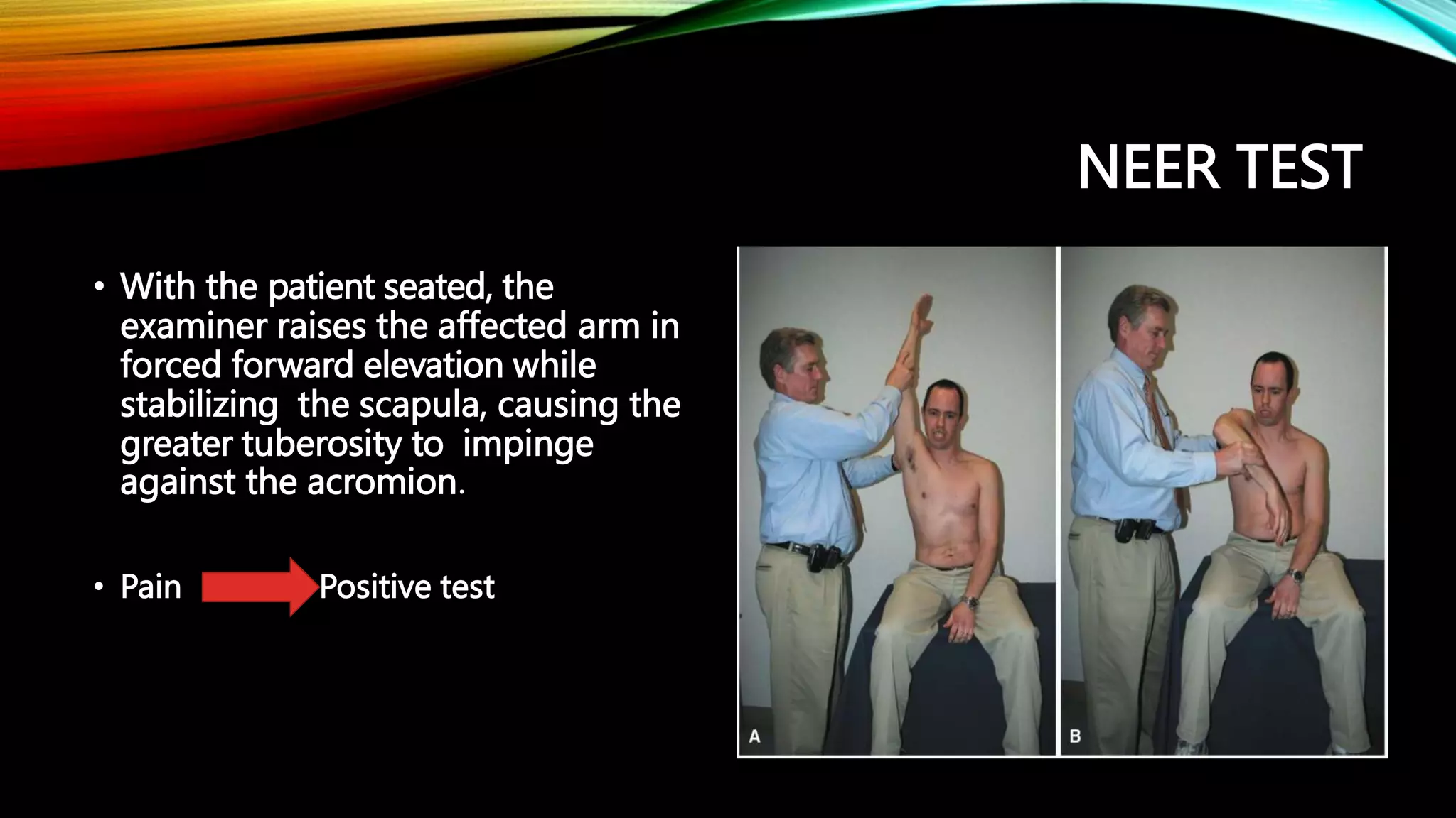 Painful Arc Syndrome.pptx