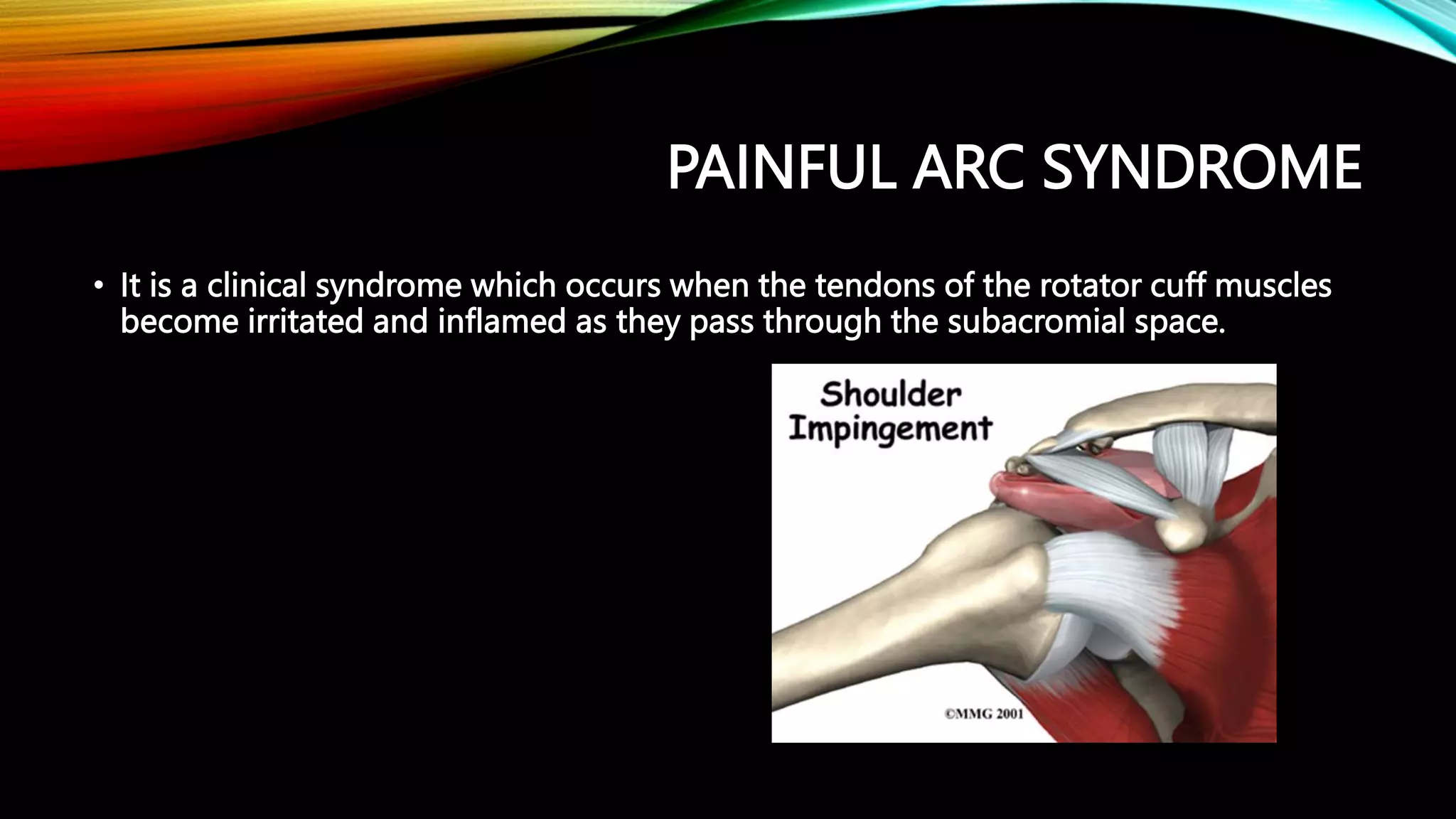 Painful Arc Syndrome.pptx