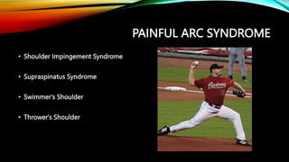 Painful Arc Syndrome.pptx