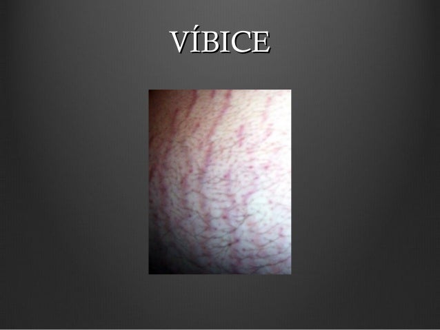 Propedêutica Dermatológica