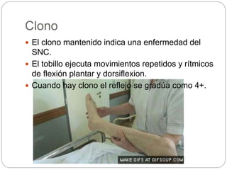 Exploración de Reflejos tendinosos profundos | PPTX