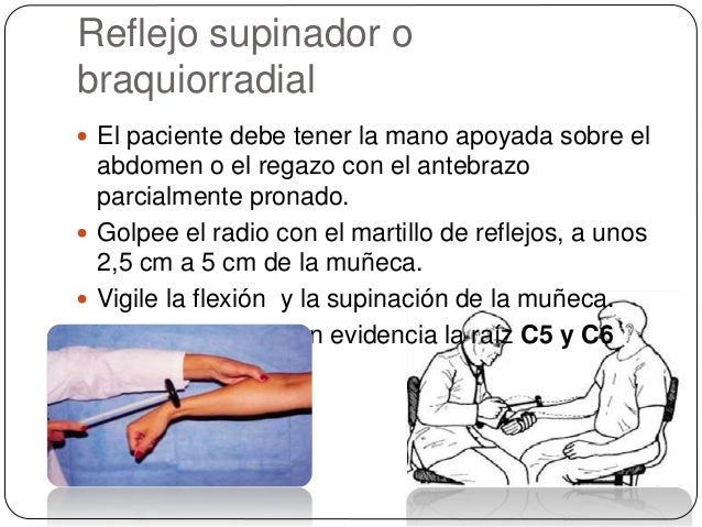 Exploración de Reflejos tendinosos profundos