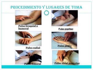 frecuencia cardiaca | PPT