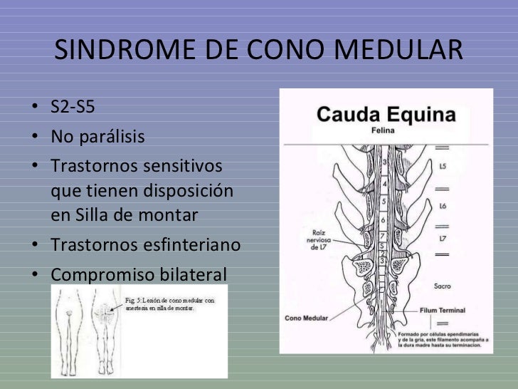 SINDROMES MEDULARES