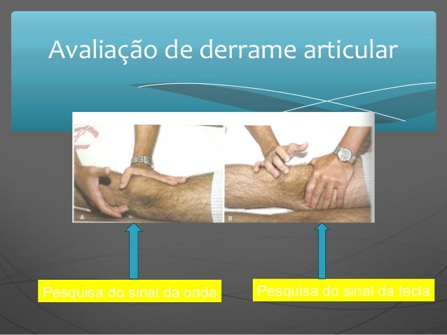 Propedêutica do Segmento Apendicular