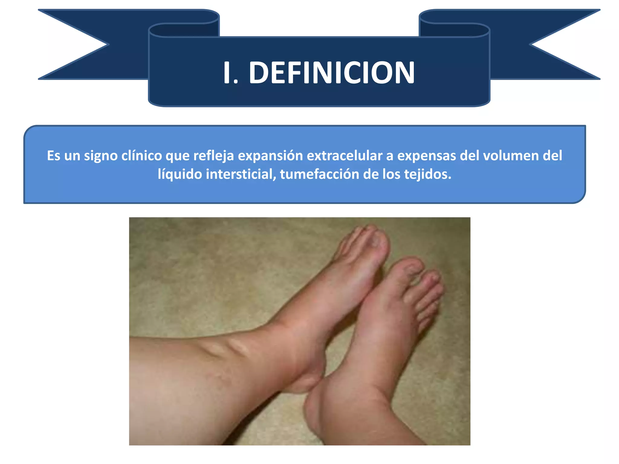 Propedeutica fiebre, edema e inflamación | PPTX