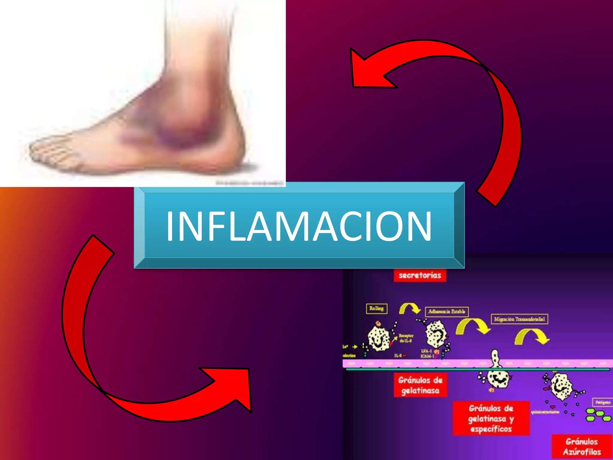 Propedeutica fiebre, edema e inflamación | PPTX