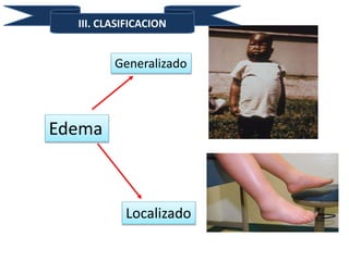 Propedeutica fiebre, edema e inflamación | PPTX