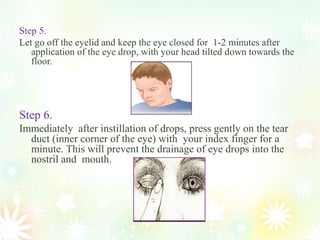 Proper eye drop administration technique | PPTX