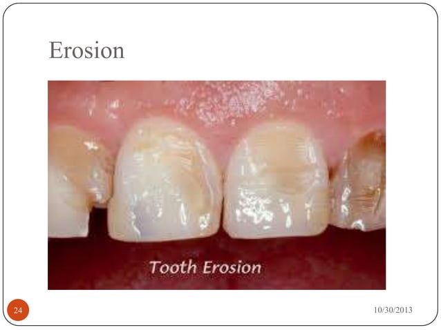 Stress & Strain Properies of dental materials | PPTX | Geology | Science