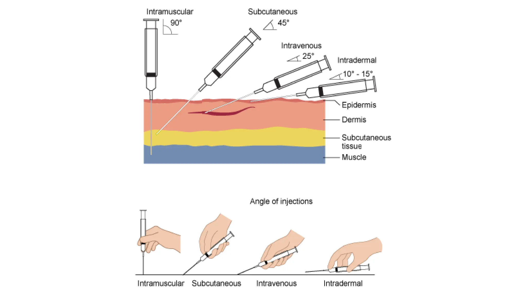 Proper Injection Techniques For nurses.pptx