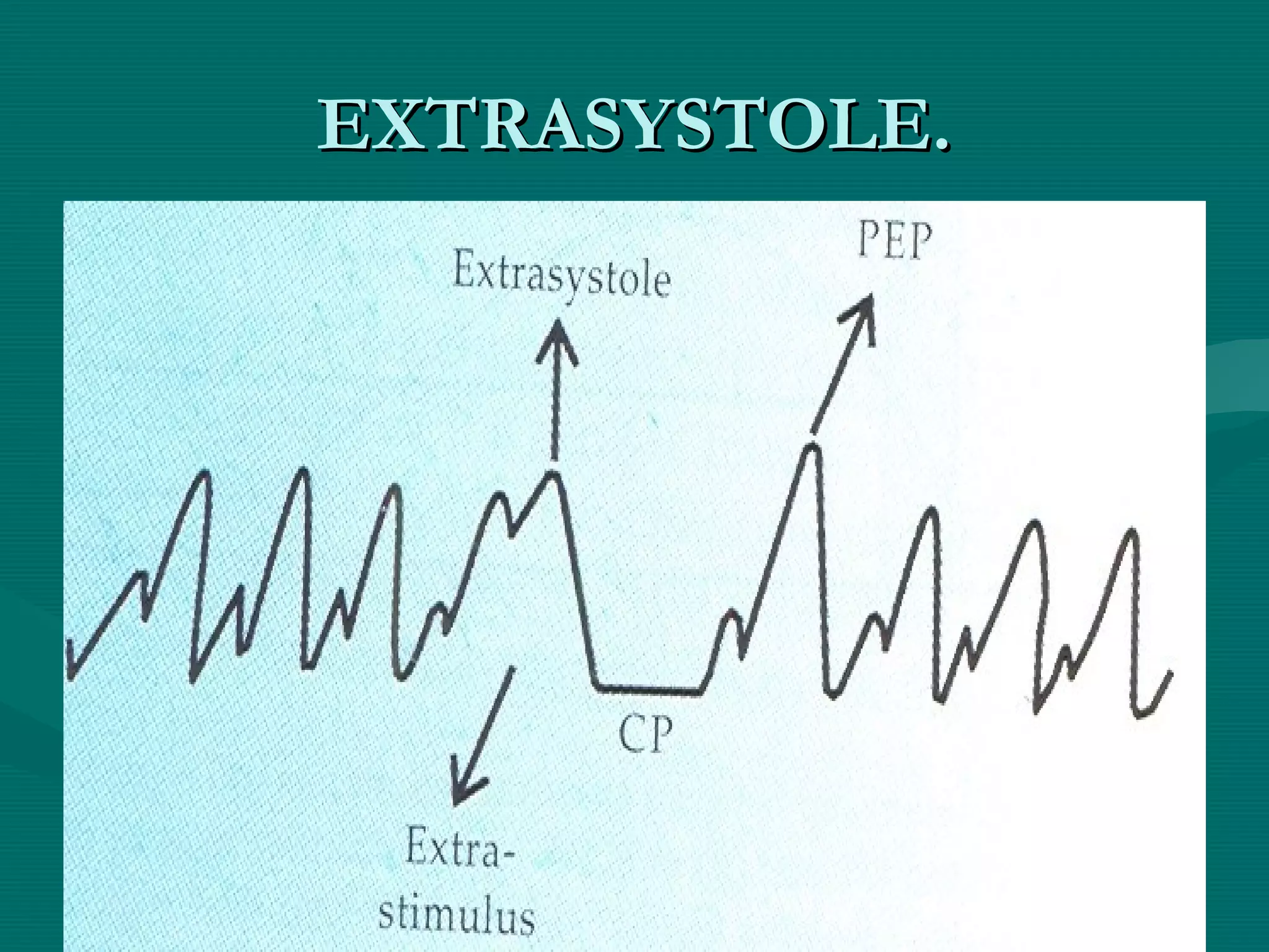 Properties of cardiac muscles | PPT