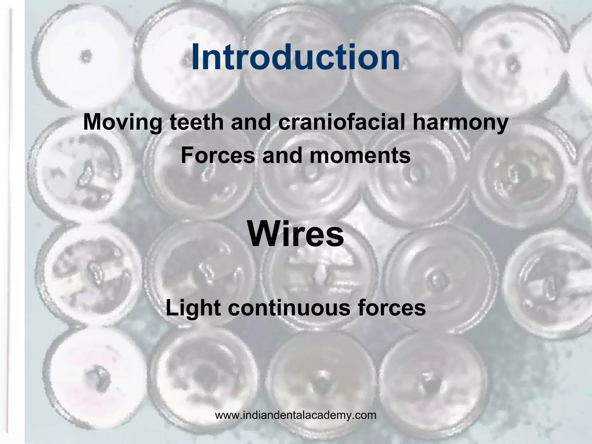 Properties of orthodontic wires | PPT