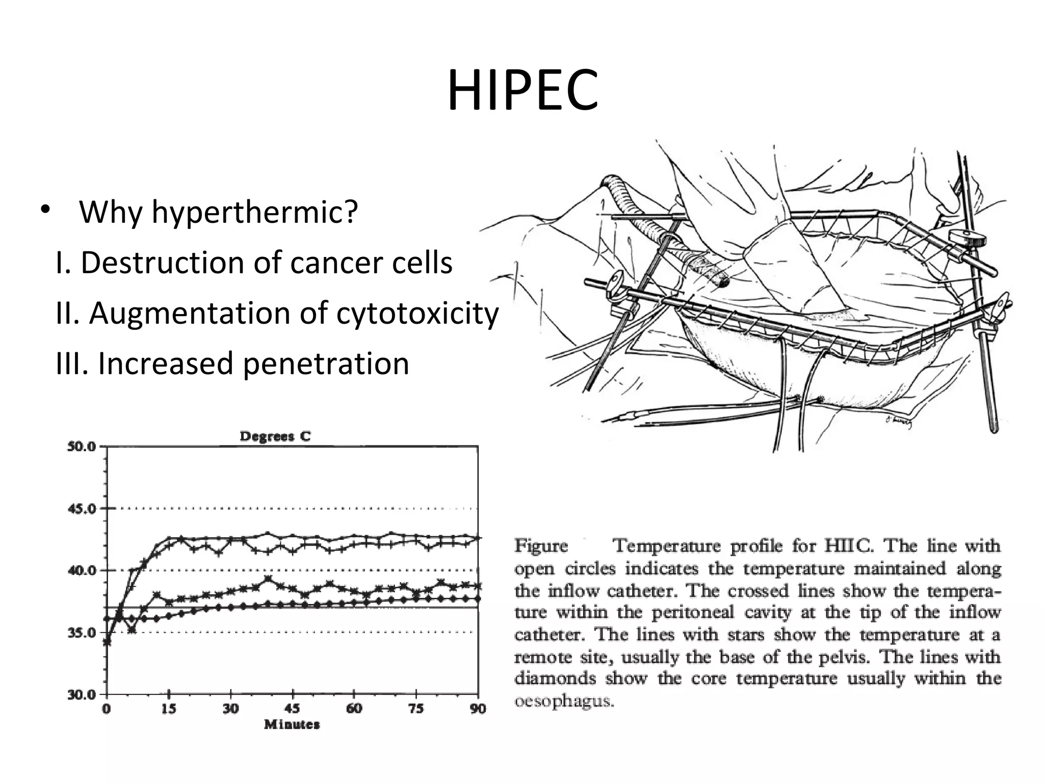 Prophylactic Cytoreduction and HIPEC | PPT