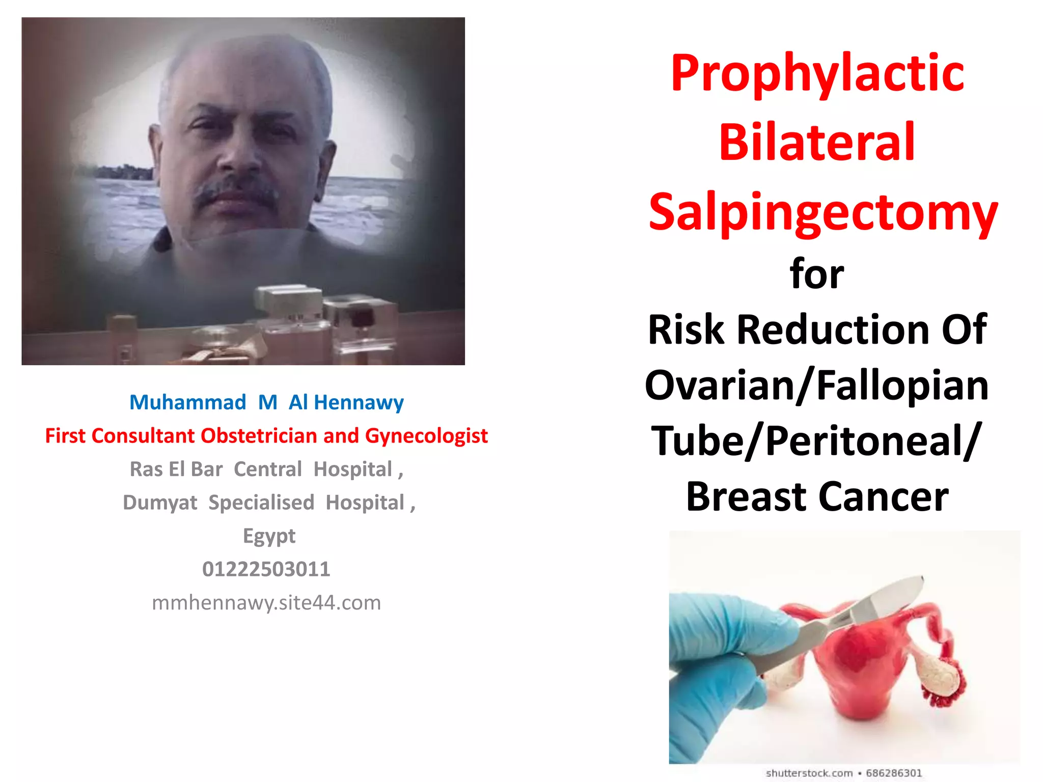 Prophylactic salpingectomy for reducing risk of ovarian cancer | PPTX