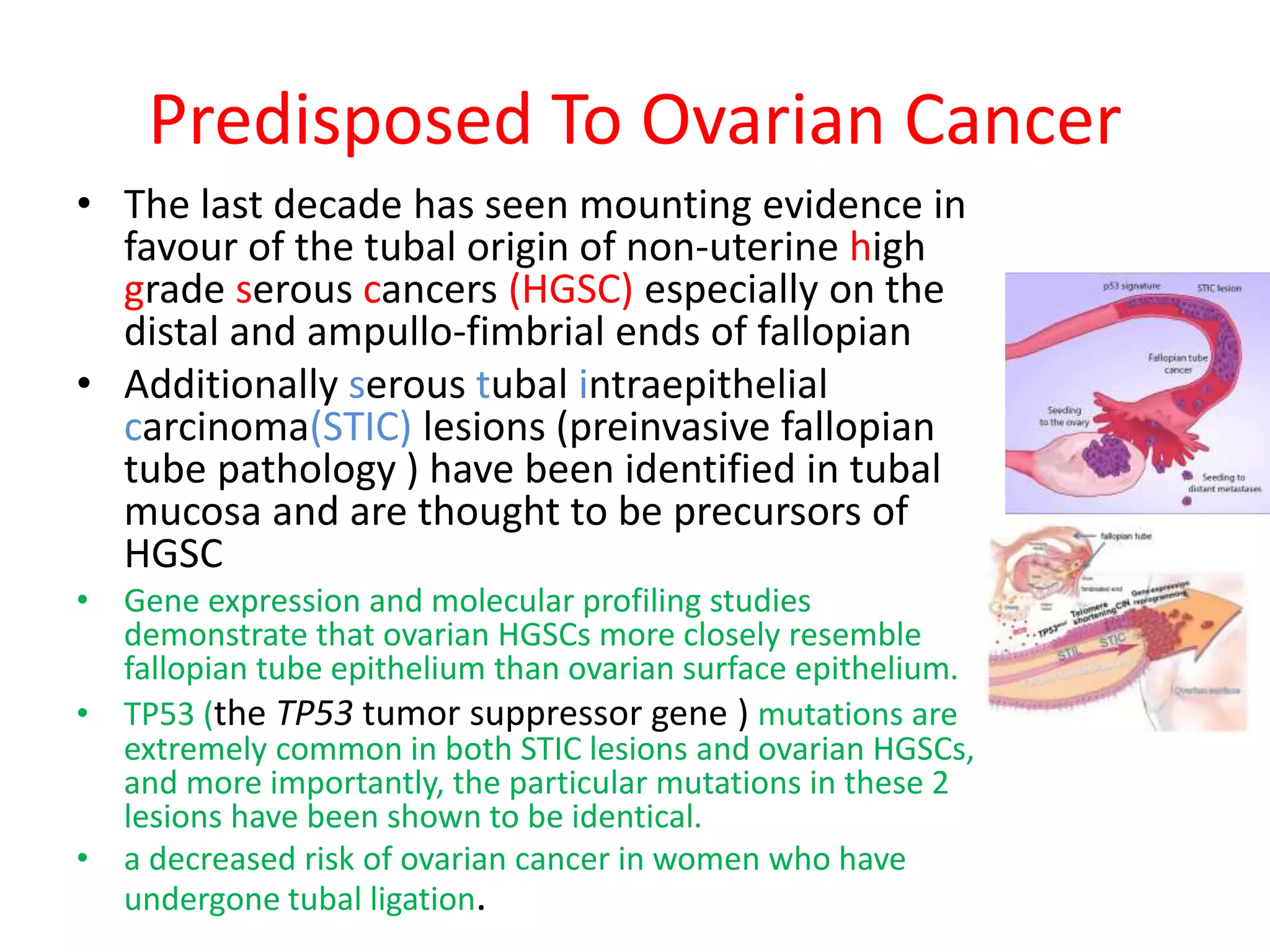 Prophylactic salpingectomy for reducing risk of ovarian cancer | PPTX
