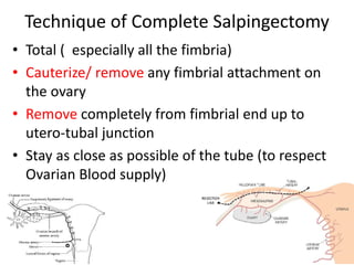 Prophylactic salpingectomy for reducing risk of ovarian cancer | PPTX