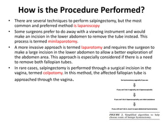Prophylactic salpingectomy for reducing risk of ovarian cancer | PPTX