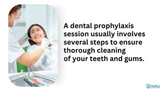 Prophylaxis Teeth Cleaning.pptx