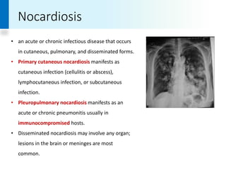 Propionibacterium, Actinomyces and Nocardia | PDF
