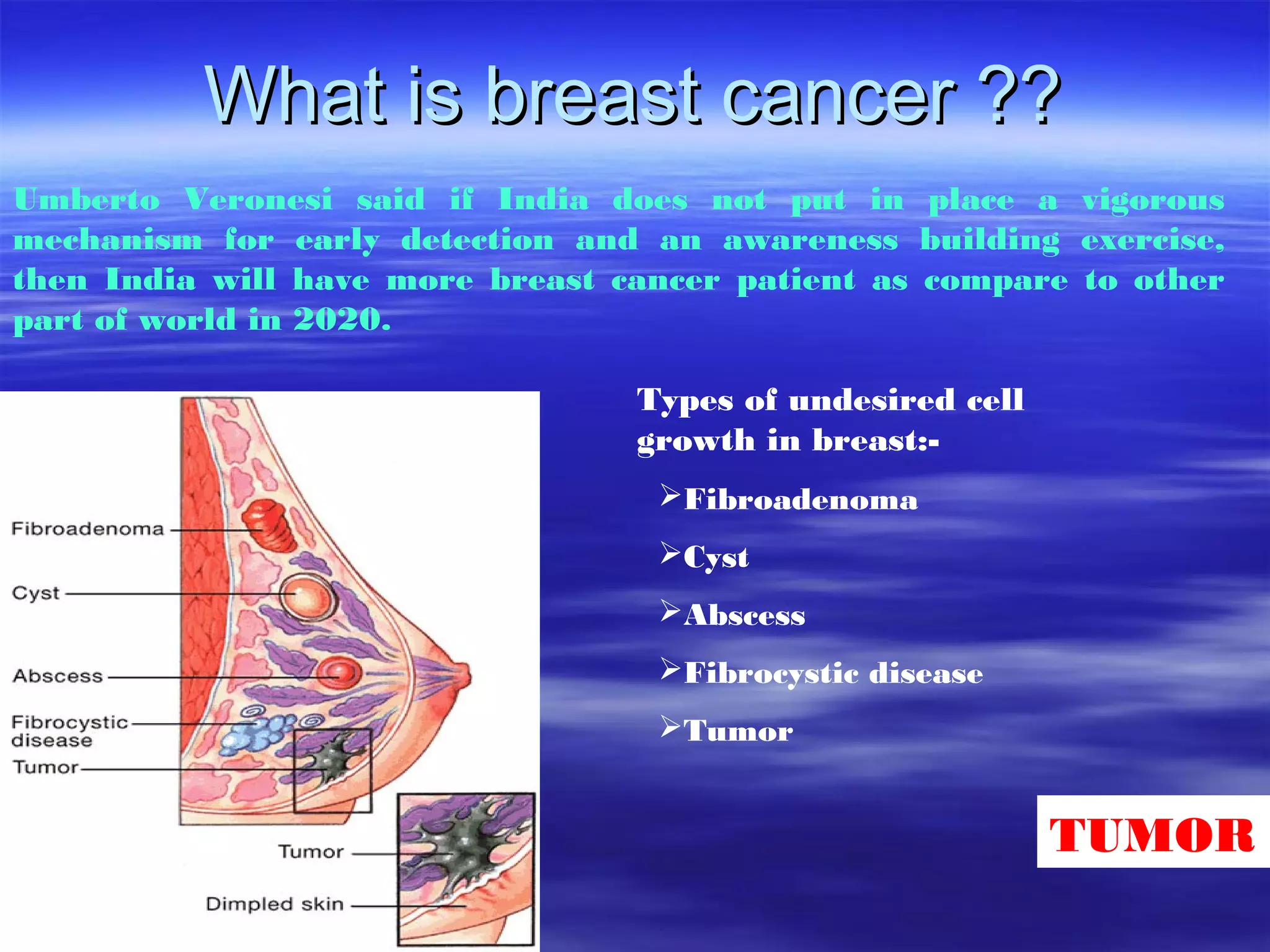 Breast cancer research | PPT