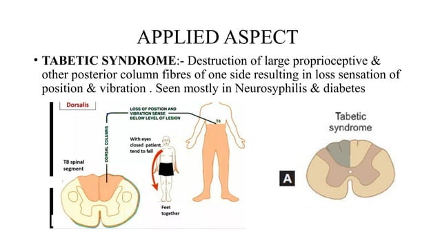 PROPRIOCEPTIVE PATHWAY.pptx involving information about sense of ...