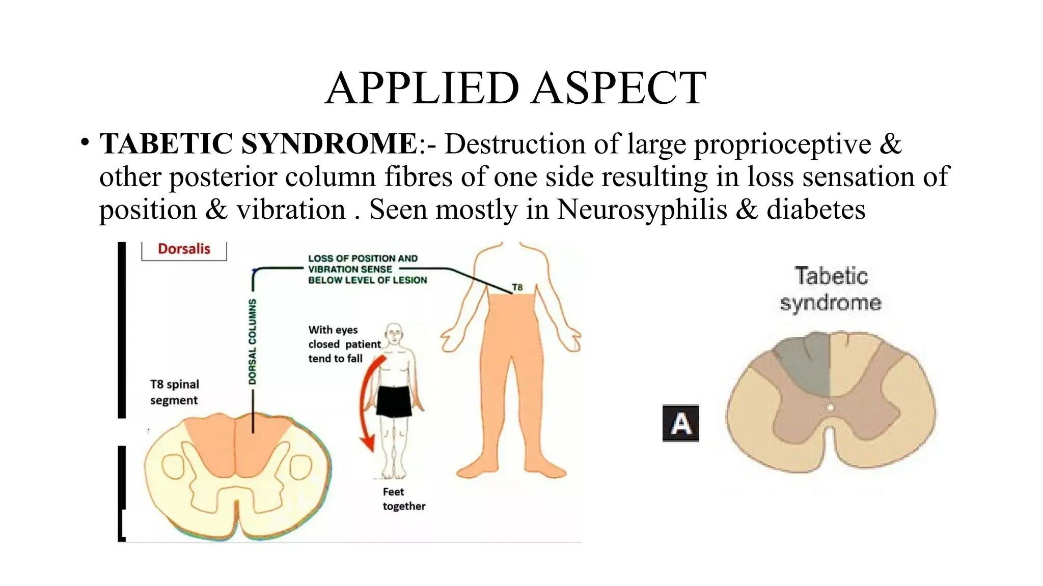 PROPRIOCEPTIVE PATHWAY (1).ppt dorsal column medial lemniscal system.x ...