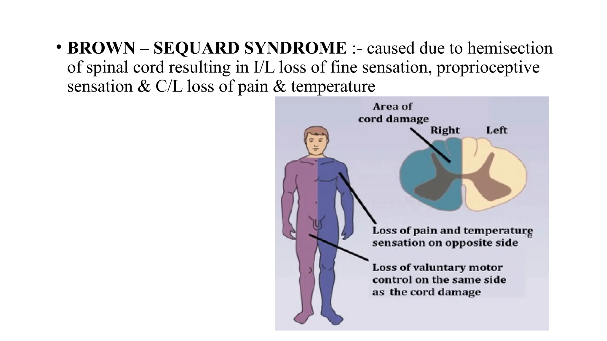 PROPRIOCEPTIVE PATHWAY (1).ppt dorsal column medial lemniscal system.x ...