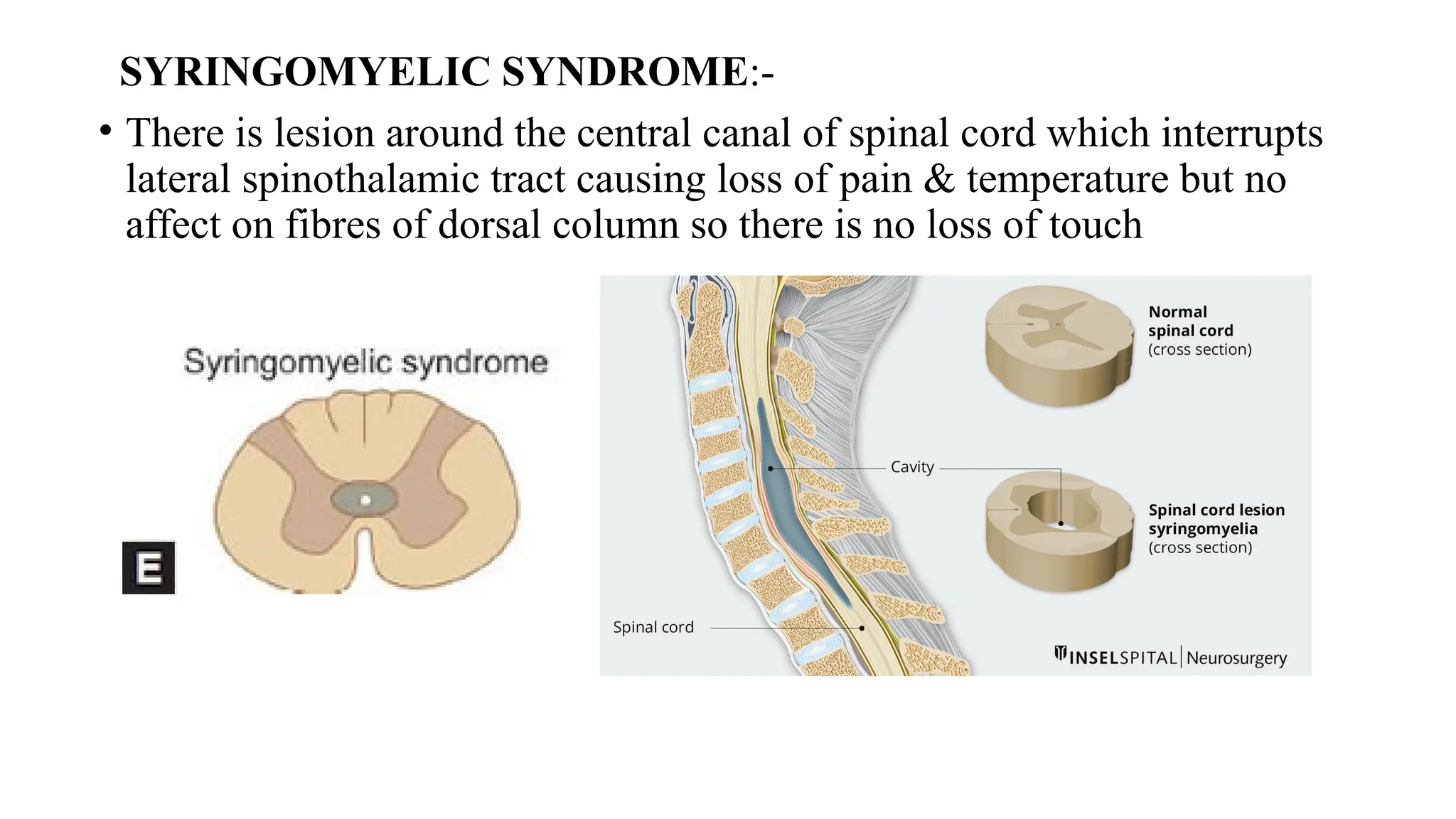 PROPRIOCEPTIVE PATHWAY (1).ppt dorsal column medial lemniscal system.x ...