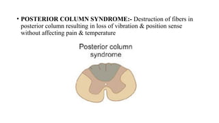 PROPRIOCEPTIVE PATHWAY (1).ppt dorsal column medial lemniscal system.x ...