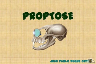 Proptose ocular | PPT