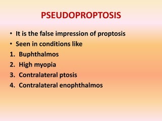 Proptosis | PPTX