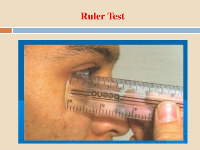 Proptosis investigation & management.rdh