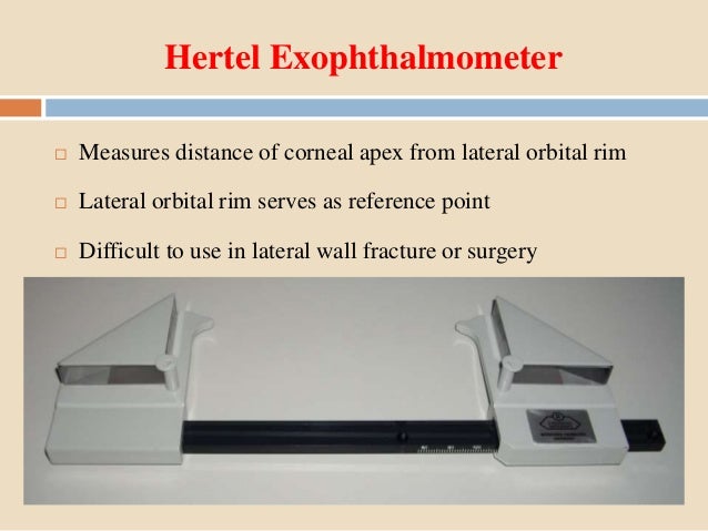 Proptosis investigation & management.rdh