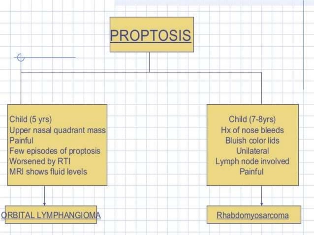 Proptosis in ophthalmology | PPTX