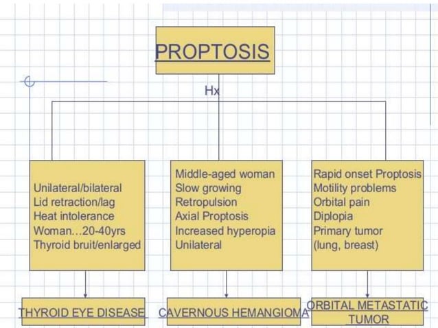 Proptosis in ophthalmology | PPTX