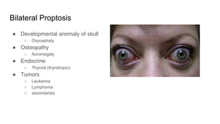 Proptosis.pptx