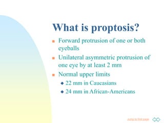 Proptosis.PPT