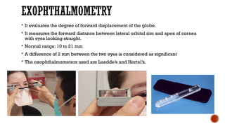 proptosis 2.pptx......................... | PPT