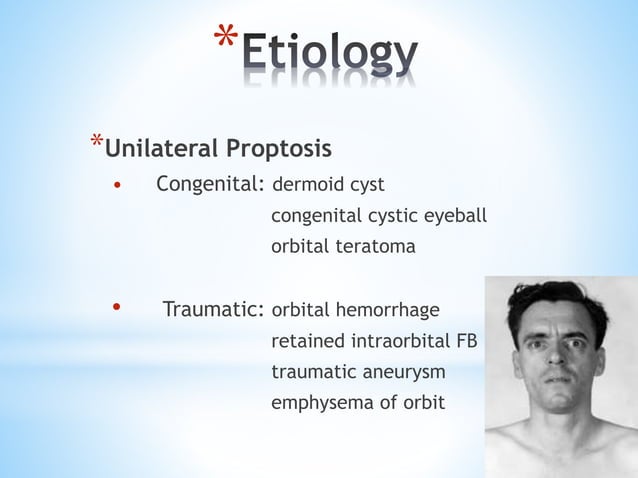Proptosis | PPTX | Eye and Vision Conditions | Diseases and Conditions