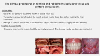 relining and rebasing | PPTX