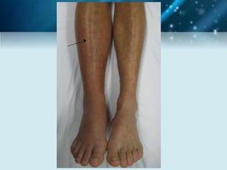 Pros and cons of pop application | PPTX